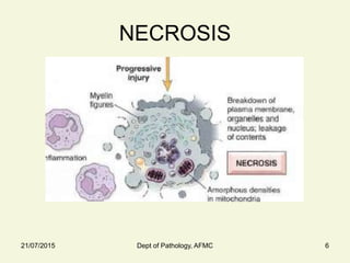 Necrosis and gangrene | PPT