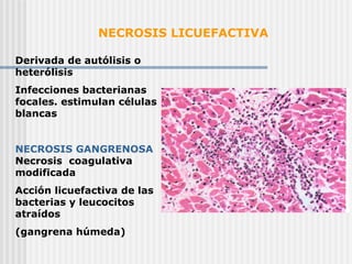 BIOLOGIA MOLECULAR DE LA APOPTOSIS | PPS