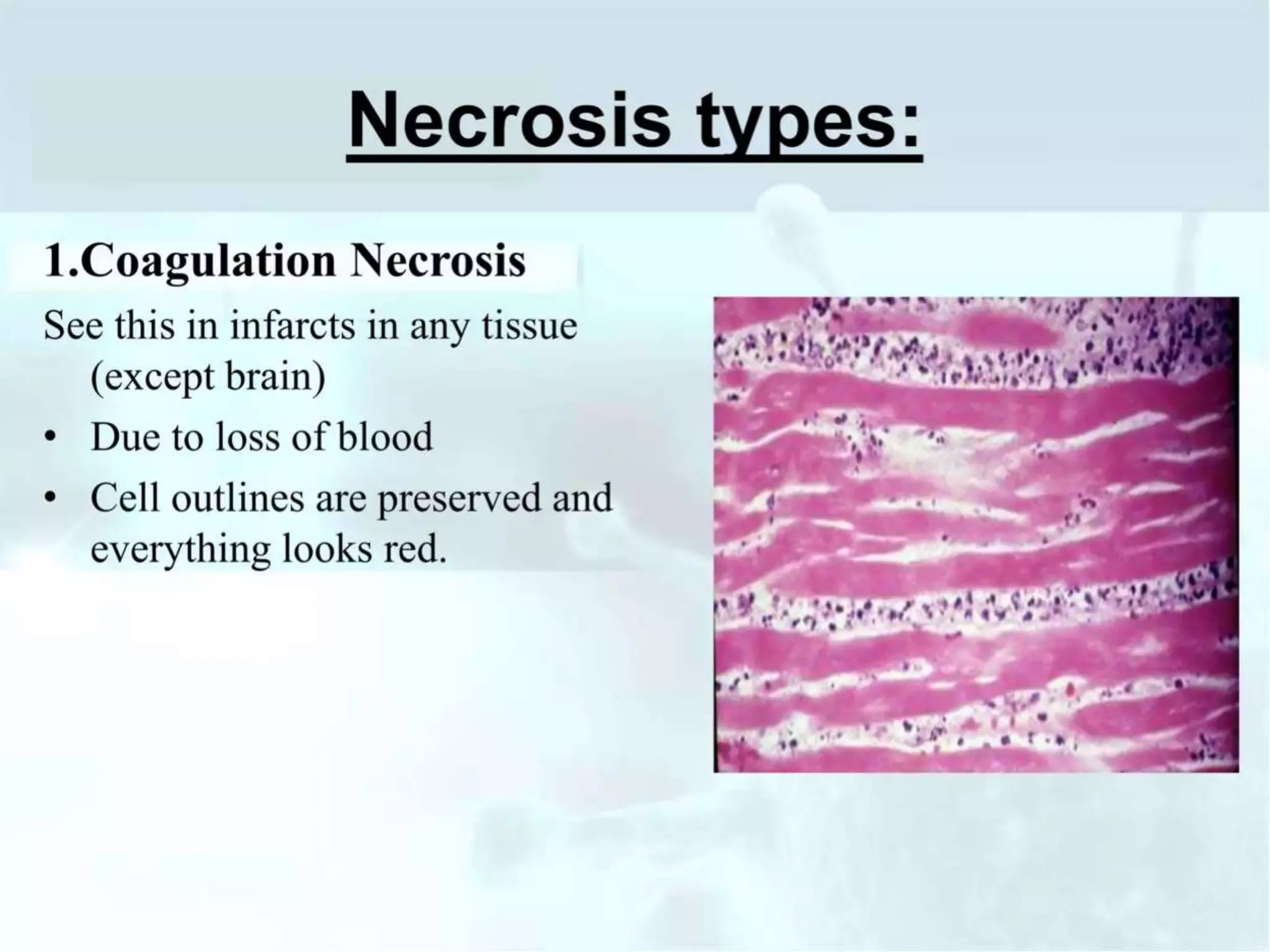 Necrosis & Apoptosis ppt | PPT