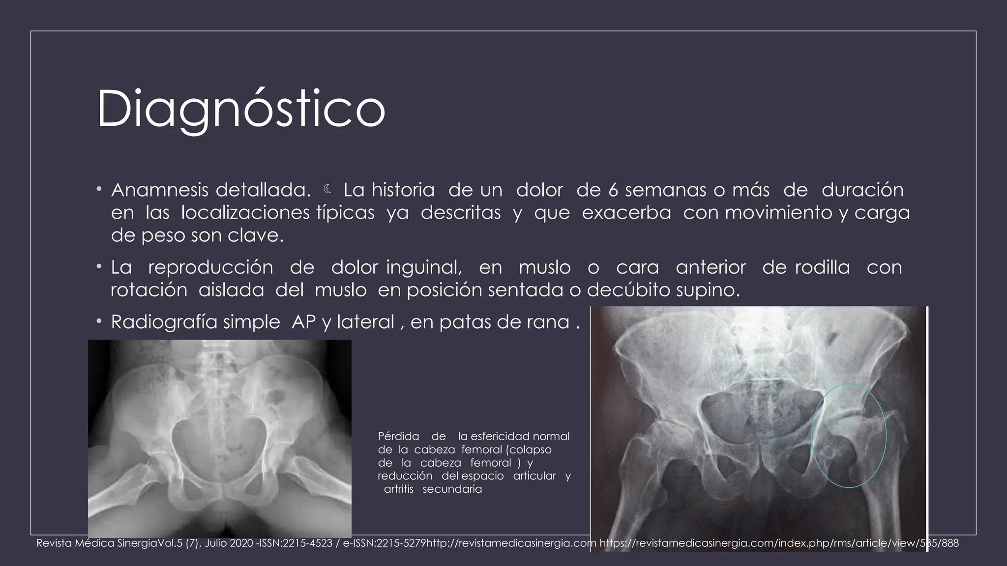 Necrosis avascular de la cabeza del fémur.pptx