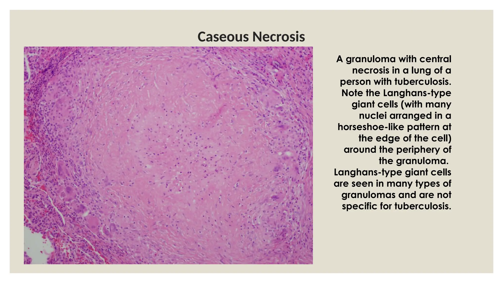 Necrosis and calcification overview.pptx