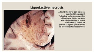 Necrosis and calcification overview.pptx