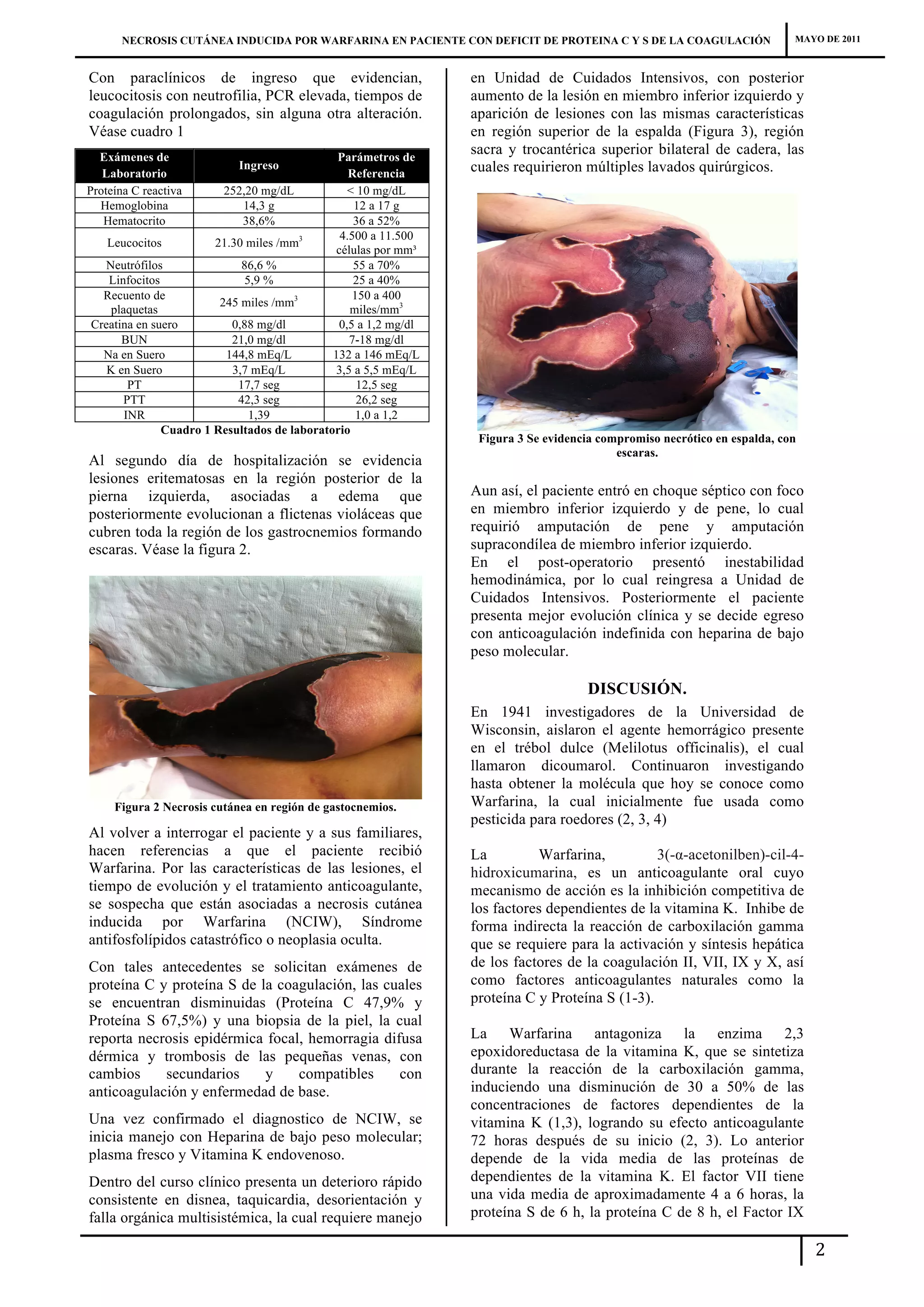 Necrosis cutanea por warfarina | PDF