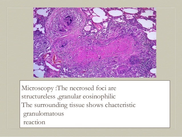 Necrosis & gangrene pathology calcification