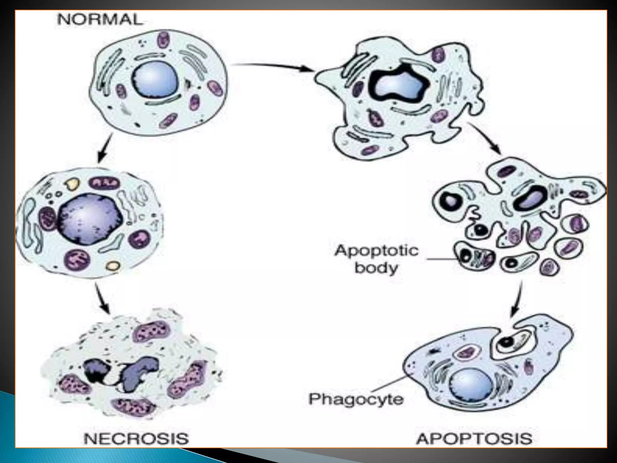 Necrosis,gangrene and apoptosis | PPTX