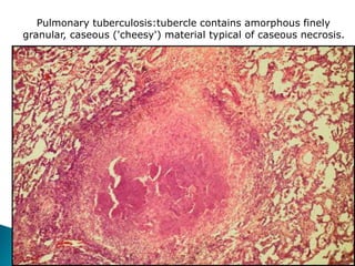 Necrosis,gangrene and apoptosis | PPTX