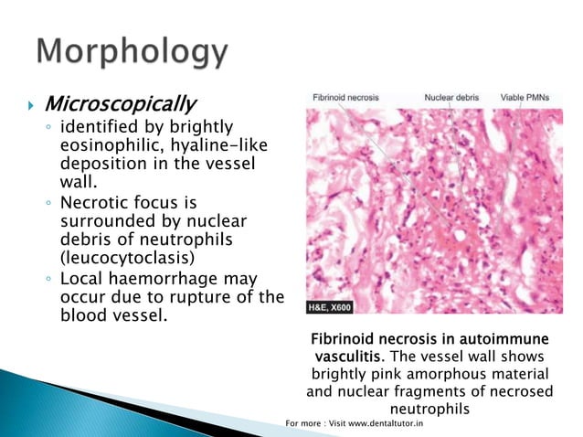Necrosis | PPTX | Biological Sciences | Science