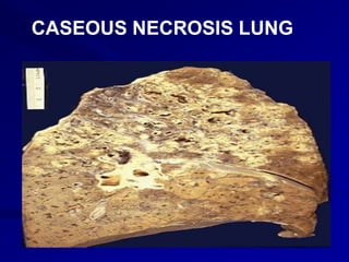 NECROSIS PEDAGOGY.pptx