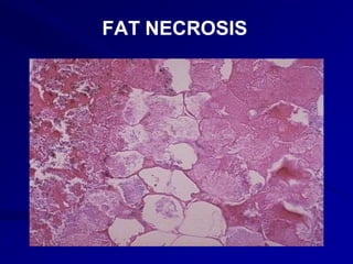NECROSIS PEDAGOGY.pptx
