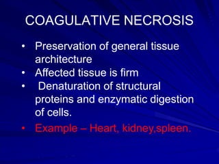 NECROSIS PEDAGOGY.pptx