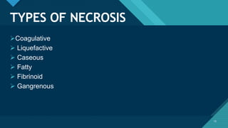 NECROSIS PPT.power point presentations n | PPTX