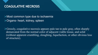 NECROSIS PPT.power point presentations n | PPTX