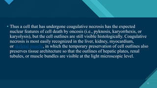 NECROSIS PPT.power point presentations n | PPTX