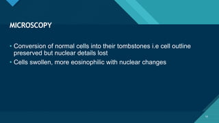 NECROSIS PPT.power point presentations n | PPTX