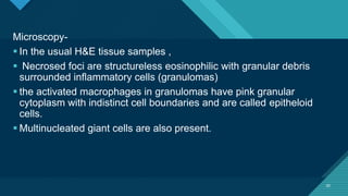 NECROSIS PPT.power point presentations n | PPTX