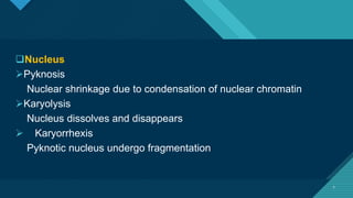 NECROSIS PPT.power point presentations n | PPTX