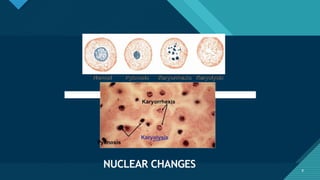 NECROSIS PPT.power point presentations n | PPTX
