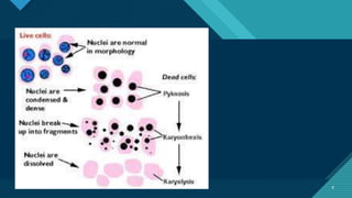 NECROSIS PPT.power point presentations n | PPTX