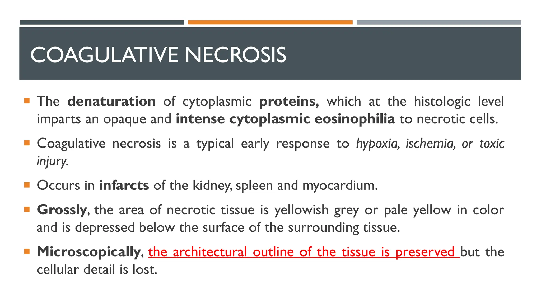 Necrosis_removed.pdfhhhhhhhhhhhhhhhhhhhh | PDF