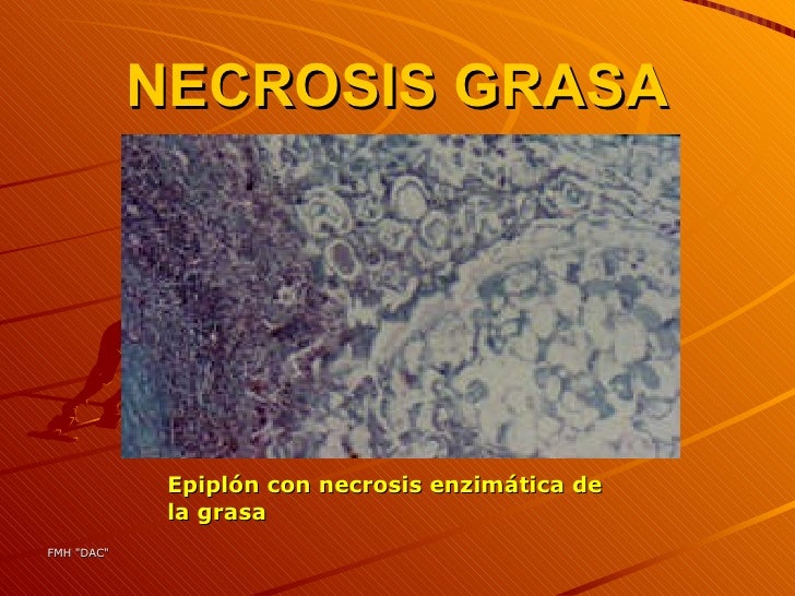 Necrosi sss