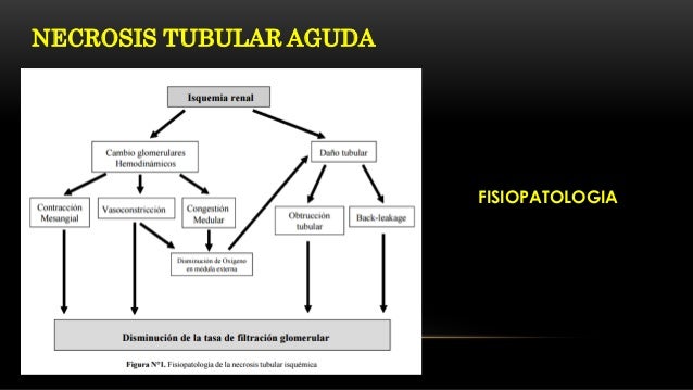 CASO CLINICO: Necrosis tubular aguda
