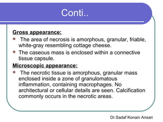 Necrosis tutorial | PPT | Blood Disorders | Diseases and Conditions