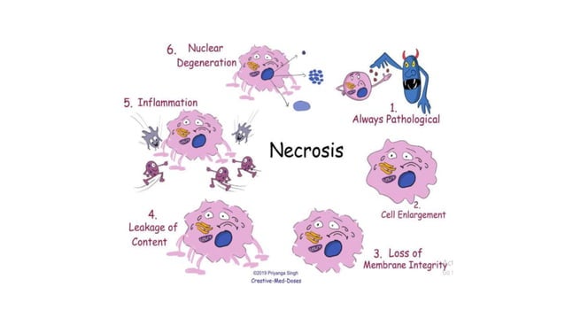 Necrosis updated pathology powerpoint presentation .pptx