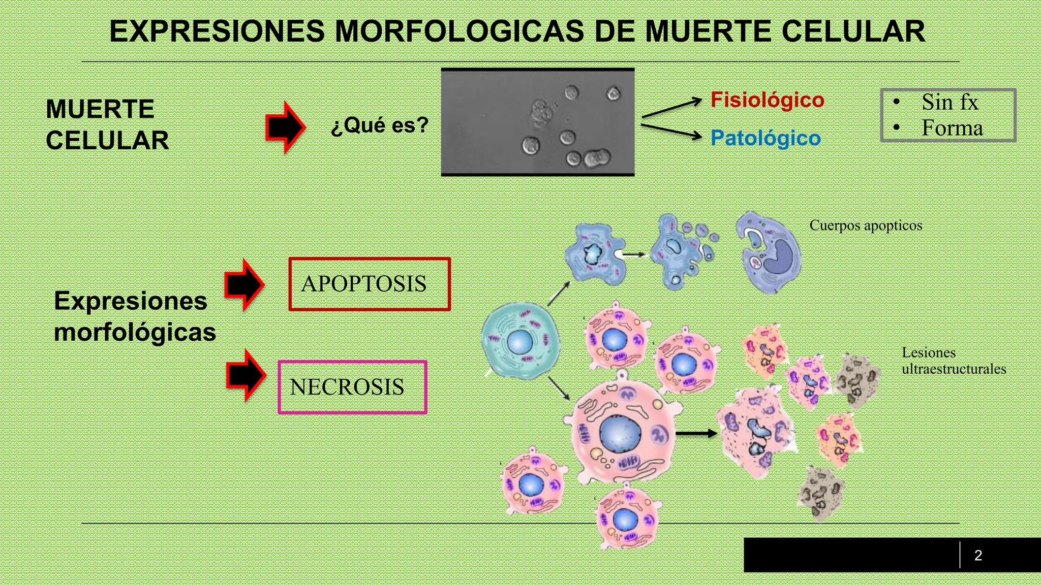 NECROSIS licuefactiva gangrenosa caseosa .pptx