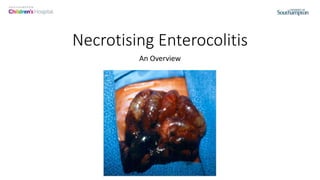 necrotising_enterocolitis__an_overview_-_paeds_teaching.pptx