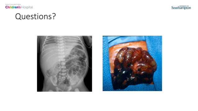 necrotising_enterocolitis__an_overview_-_paeds_teaching.pptx ...