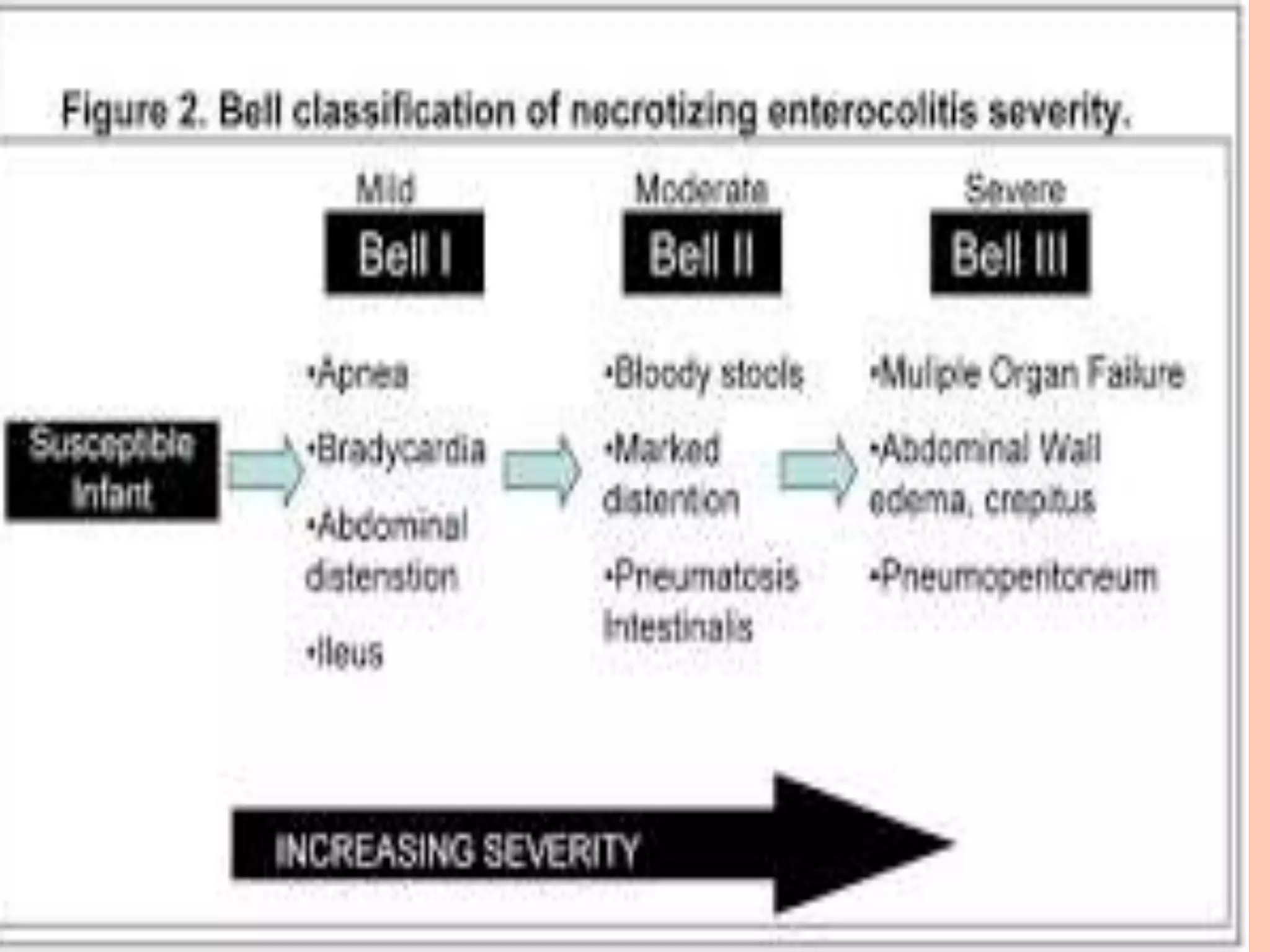 Necrotizing-enterocolitis final.ppt