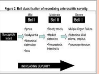 Necrotizing-enterocolitis final.ppt