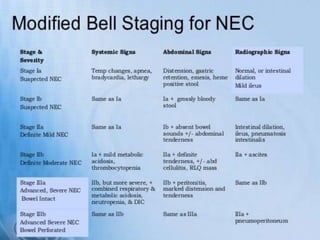 Necrotizing enterocolitis | PPTX