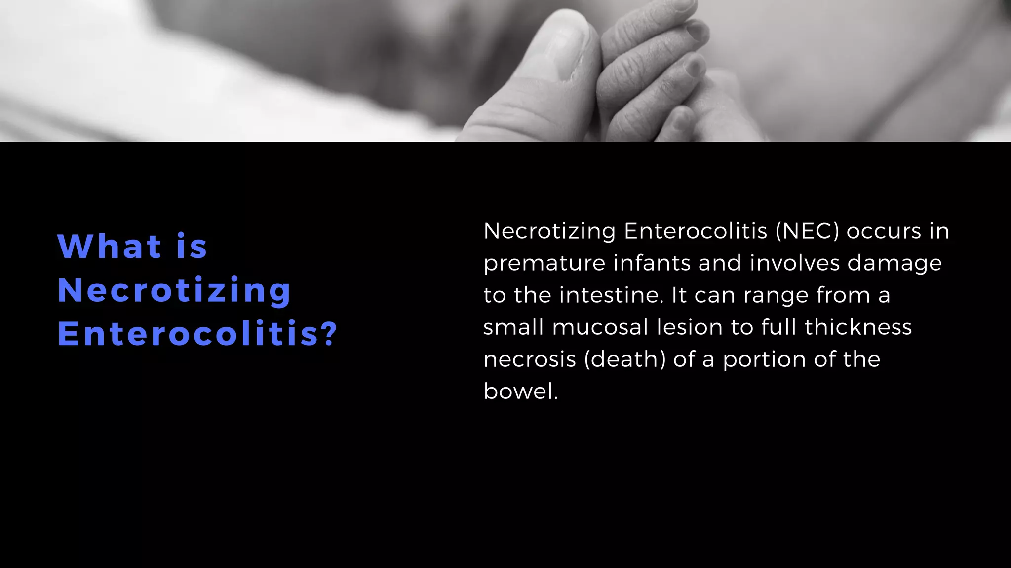 Necrotizing Enterocolitis (NEC) in Premature Babies | PDF