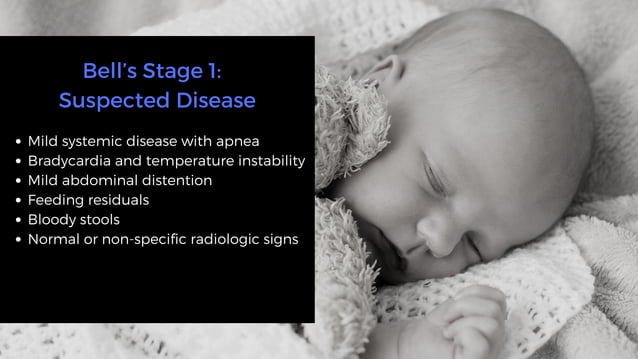 Necrotizing Enterocolitis (NEC) in Premature Babies | PDF