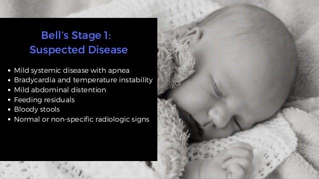 Necrotizing Enterocolitis (NEC) in Premature Babies