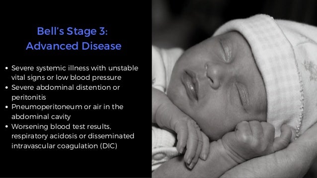 Necrotizing Enterocolitis (NEC) in Premature Babies