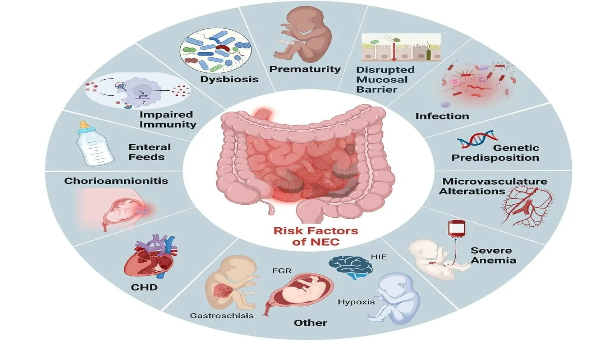 necrotizing ENTEROCOLITUS definition, incidence, pathophysiology, risk ...