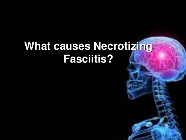 Necrotizing Fasciitis Definition