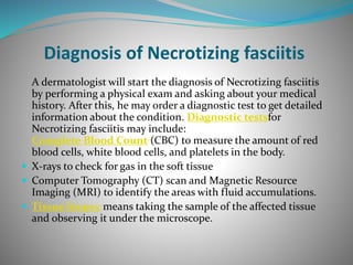 Necrotizing fasciitis | PPTX