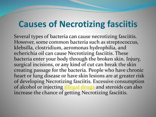 Necrotizing fasciitis | PPT