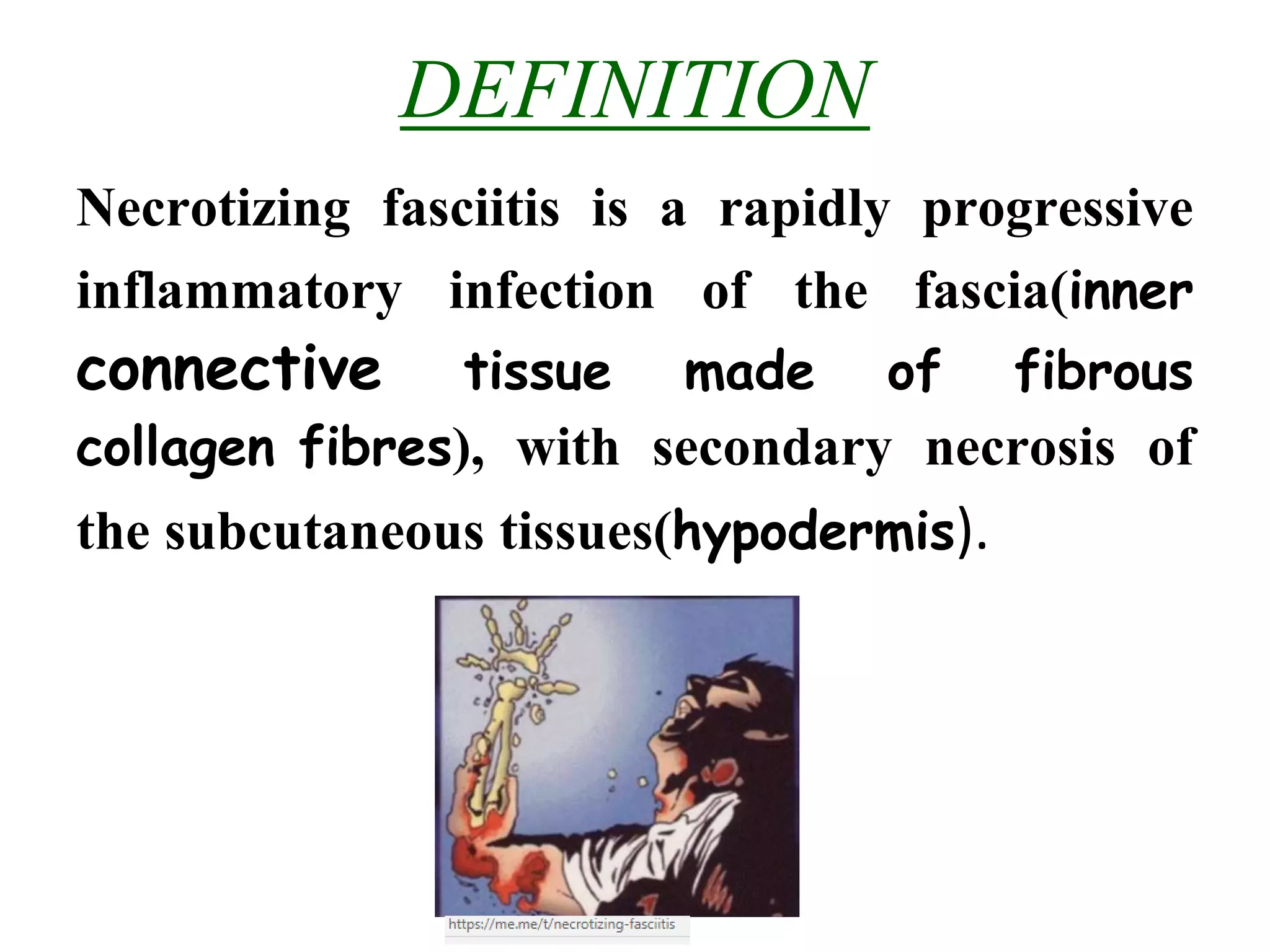 Necrotizing fasciitis | PPTX