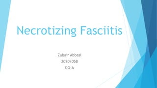 Necrotizing Fasciitis ppt by Dr Ahmed Zubair Abbasi.pptx