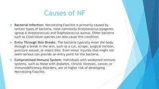 Necrotizing Fasciitis ppt by Dr Ahmed Zubair Abbasi.pptx