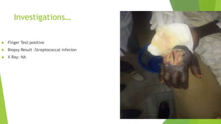 Necrotizing fasciitis and role of physiotherapy | PPTX