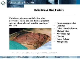 Necrotizing fasciitis and velopharyngeal aplasia by dr.damodhar.m.v | PPT