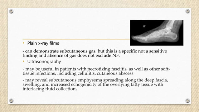 NECROTIZING FASCIITIS, GAS GANGRENE AND SEPTIC ARTHRITIS (1).pptx ...