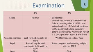necrotizing scleritis - CASE PRESENTATION | PPTX