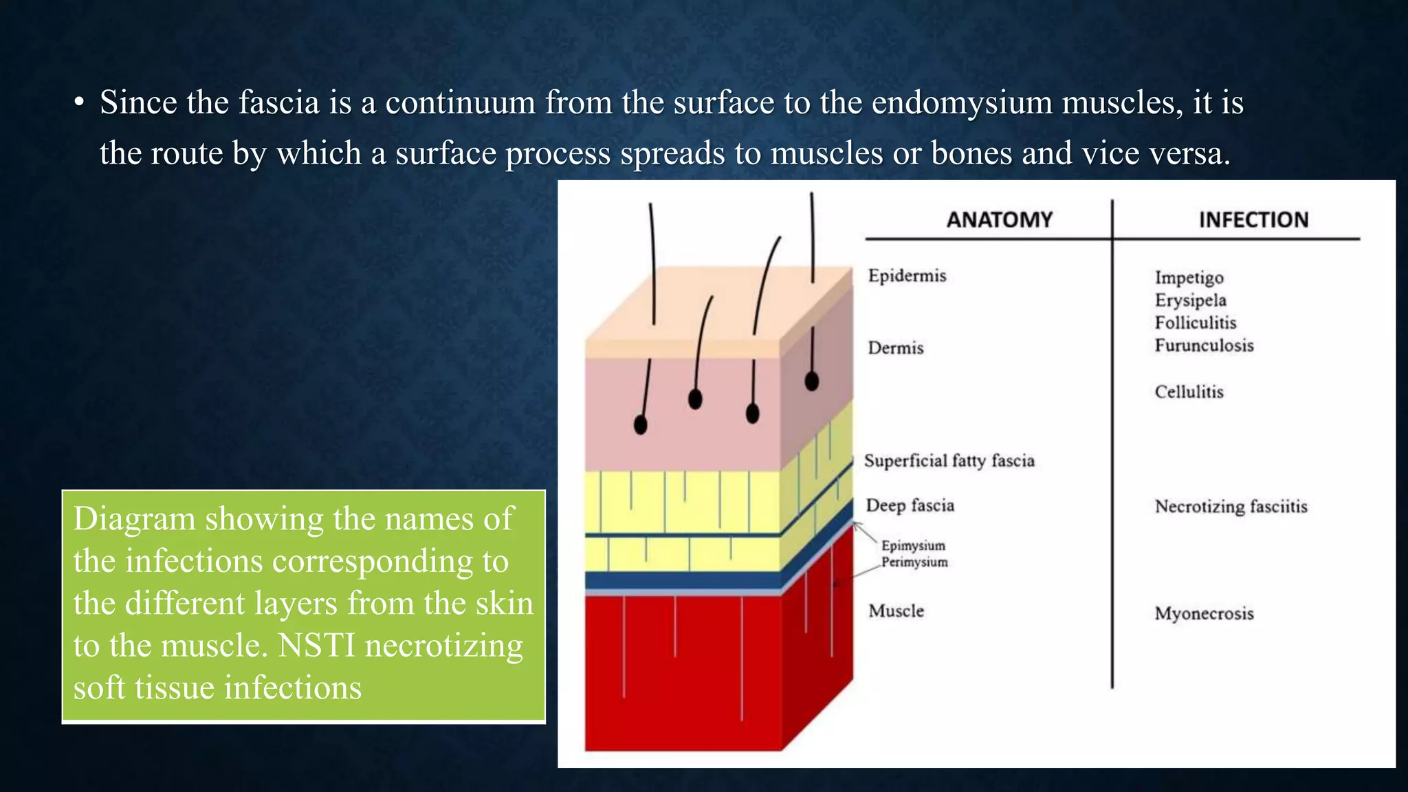 NECROTIZING SOFT TISSUE INFECTION.pptx