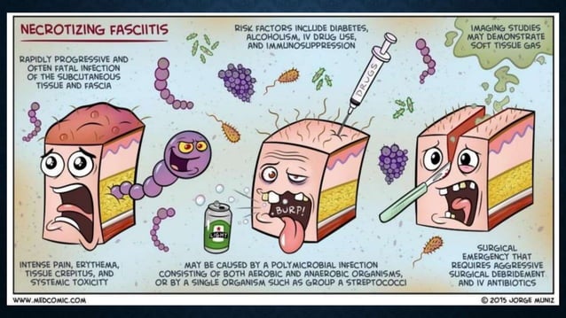 NECROTIZING SOFT TISSUE INFECTION.pptx | Skin and Dermatology ...
